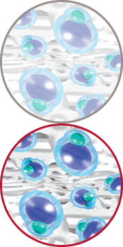 Infyna intermitterende katheter | Hollister NL